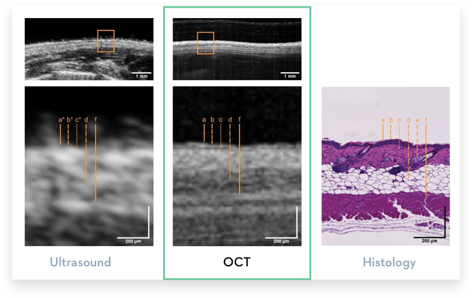 OCT imaging for intraoperative margin visualization | Perimeter Medical