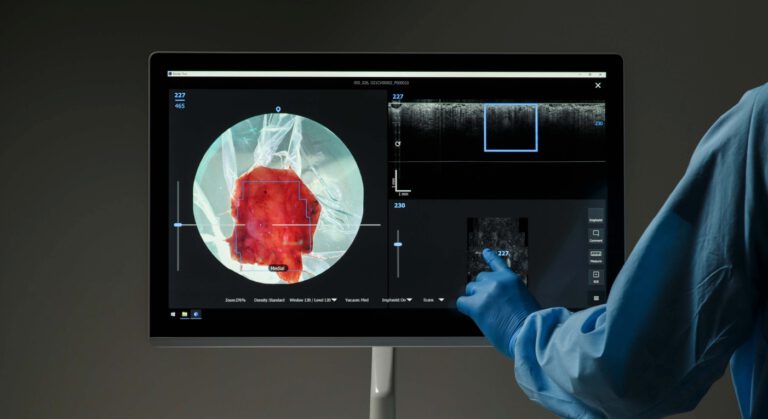 How Perimeter OCT fits into surgical workflow | Perimeter Medical
