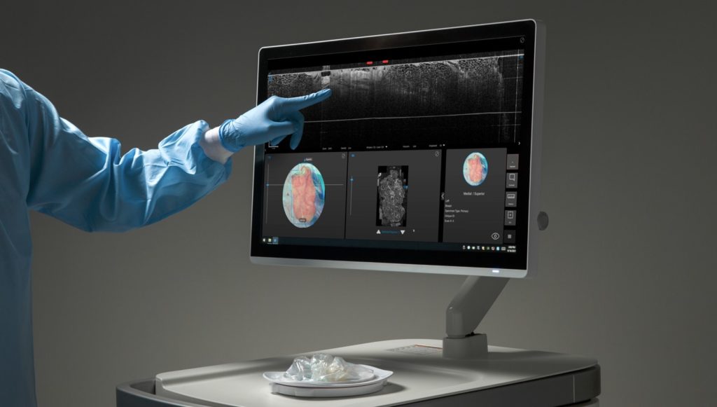 Cellular-level intraoperative margin visualization for excised tissues ...