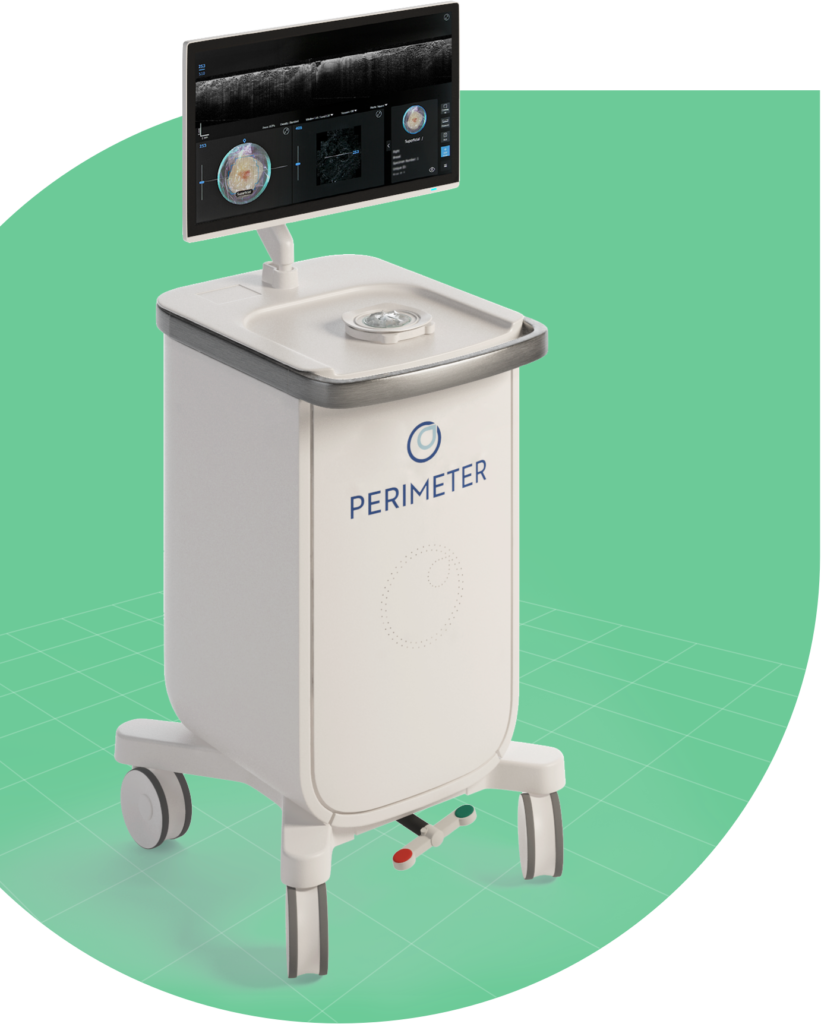 Perimeter S-Series OCT | Perimeter Medical