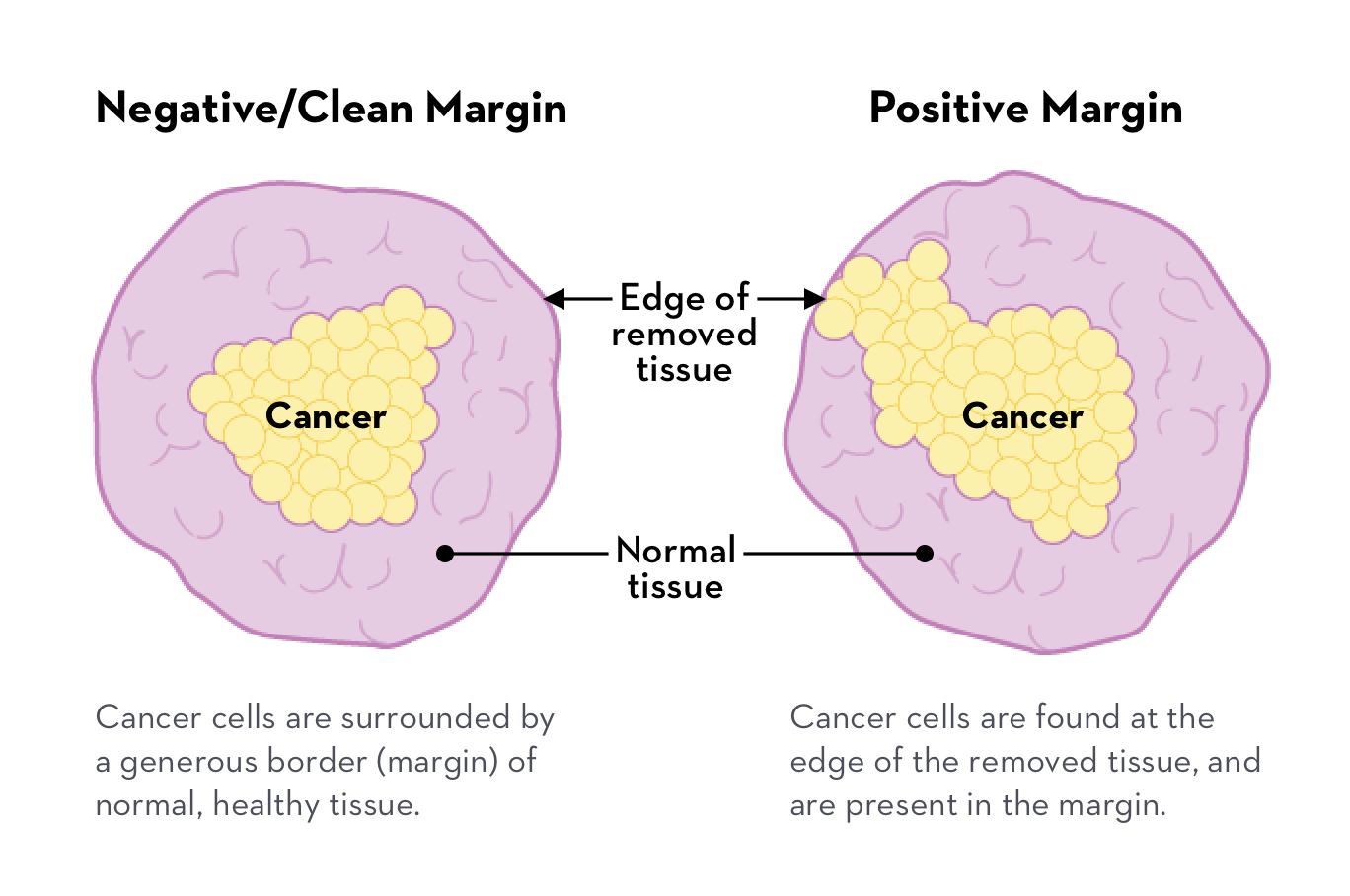 Why Clean Margins Matter | Perimeter Medical