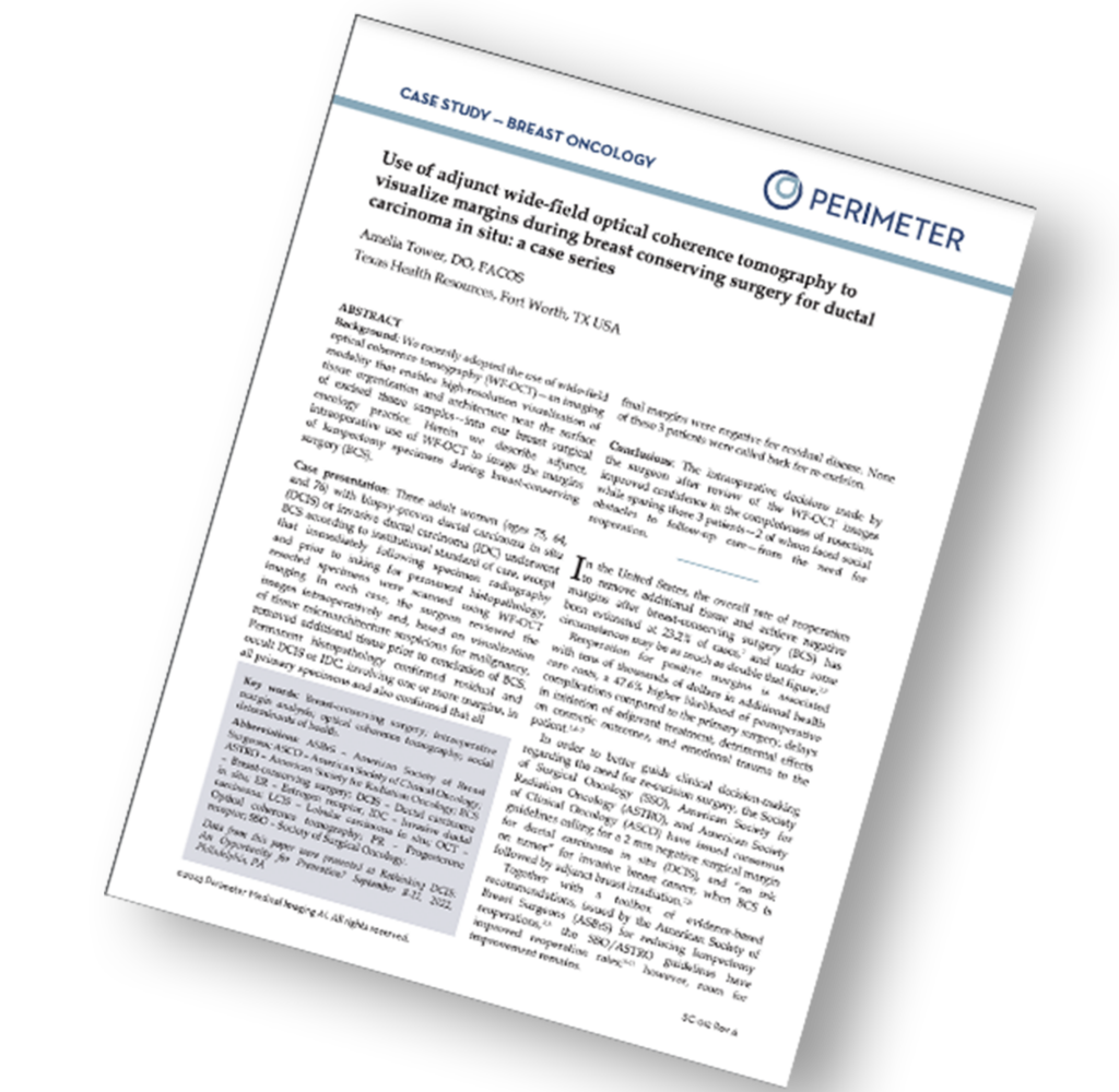 Dr. Tower Breast Oncology Case Study - Ungated | Perimeter Medical