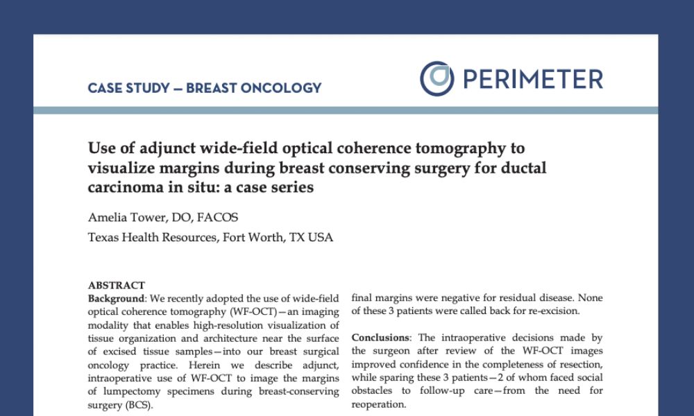 Dr. Tower Case Study News Release | Perimeter Medical