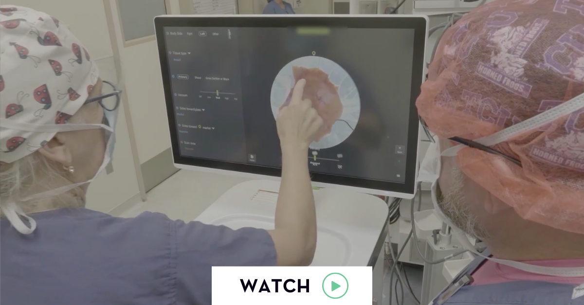 How Perimeter OCT fits into surgical workflow | Perimeter Medical